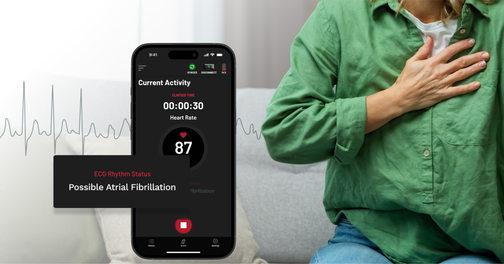 The Role of Ambulatory ECG in AFib Detection