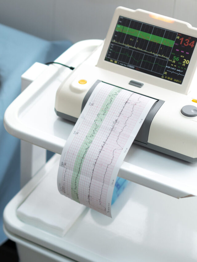 AFIB ECG: Role of ECG in Diagnosis and Treatment