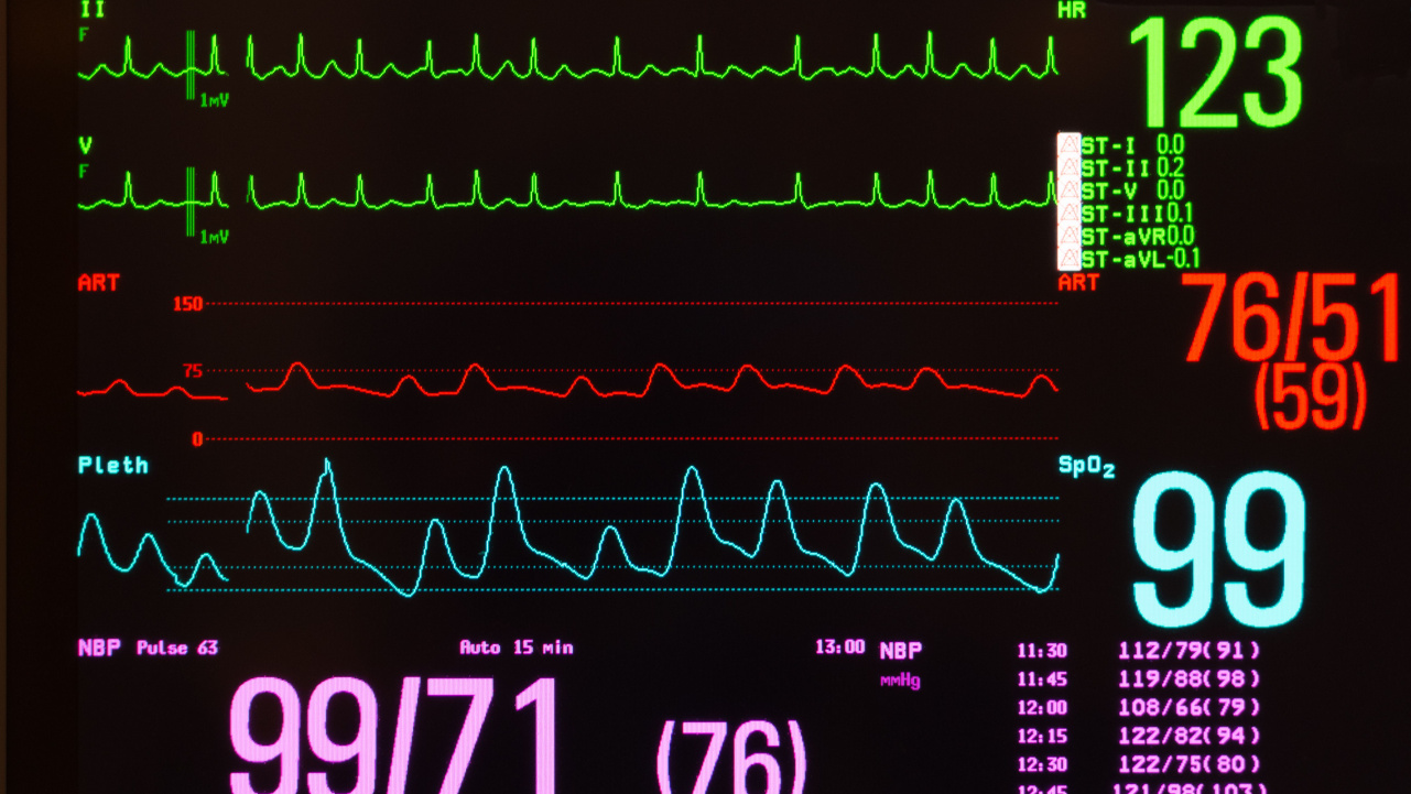 Heart Rate Variability Measurement | How to Check Your Heart Rate Variability?