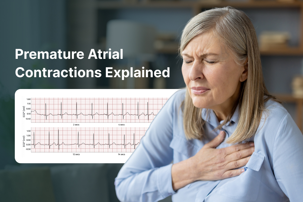 PACs: Causes, Symptoms & Risks